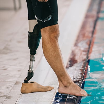 Prosthetic One Offers Prosthetics in Memphis, TN 38119